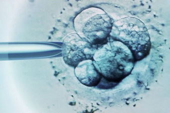 First human embryos genetically modified in U.S. - PanARMENIAN.Net