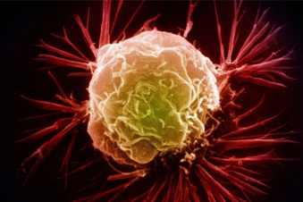 Achilles heel of many types of cancer identified in new study ...